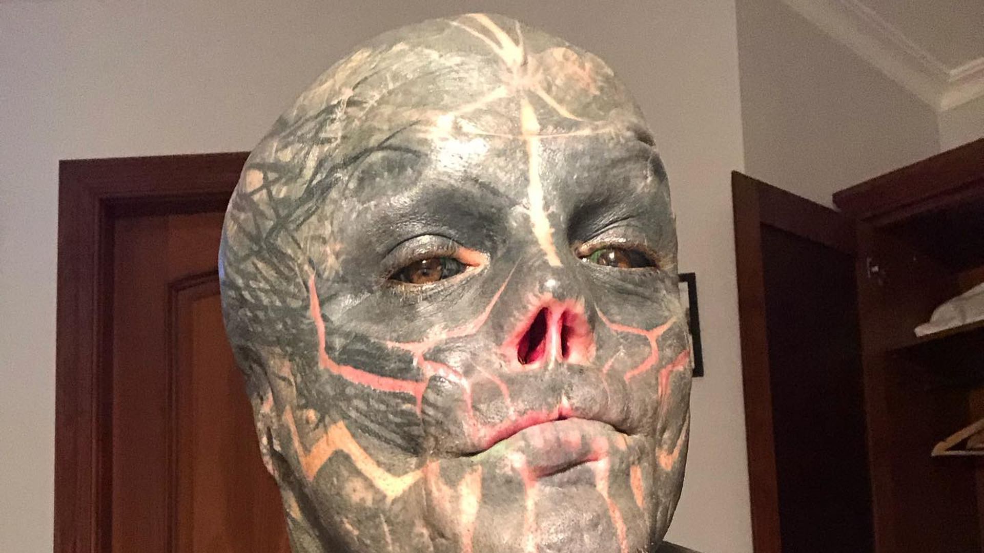 Nach Amputation: Beendet Black Alien nun Body-Modifikation?