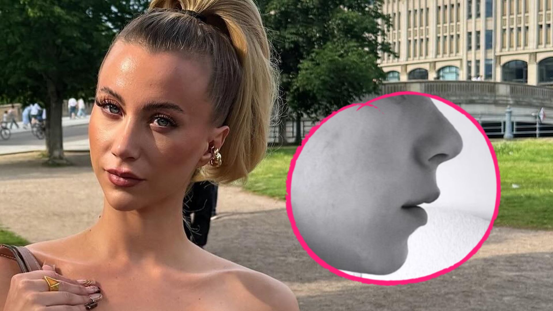 Hanni Hase zeigt Vorher-Nachher-Foto ihrer Beauty-Eingriffe