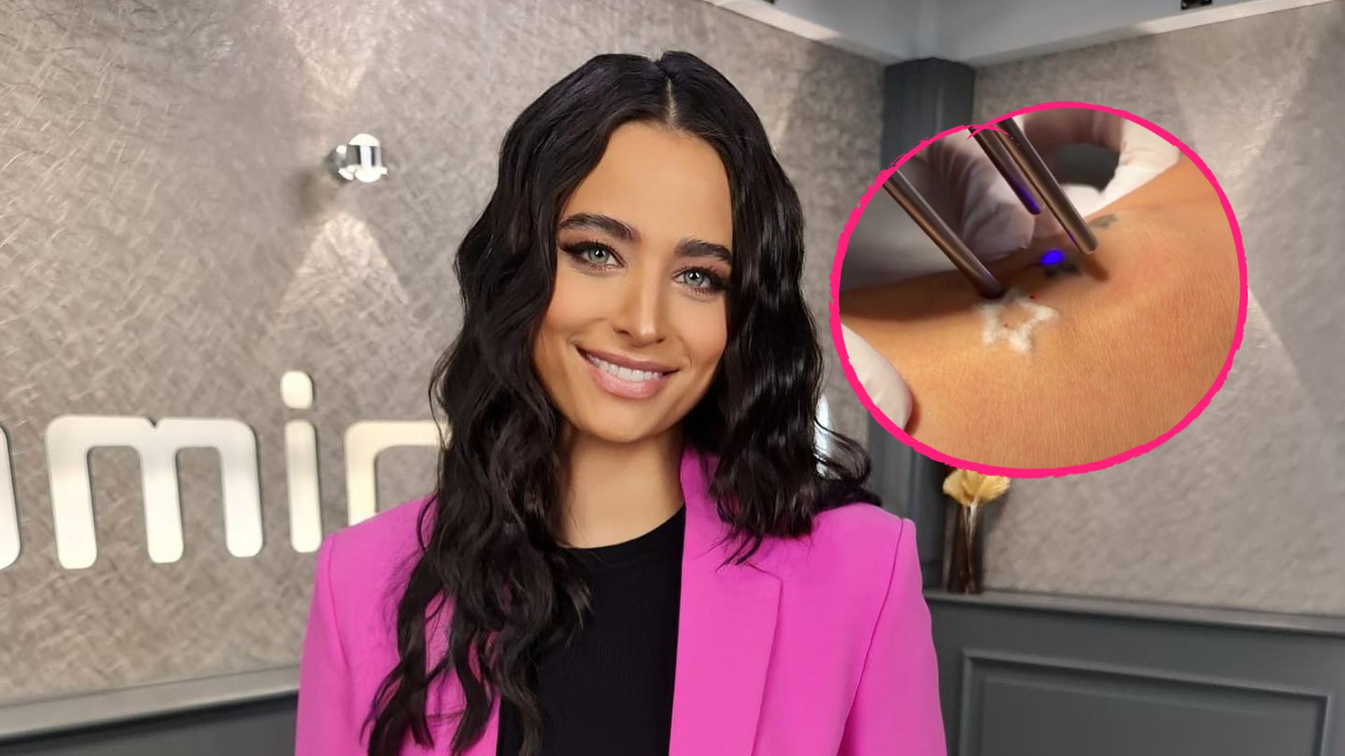 Langzeitprojekt: Amira Pocher lässt alle Tattoos entfernen!