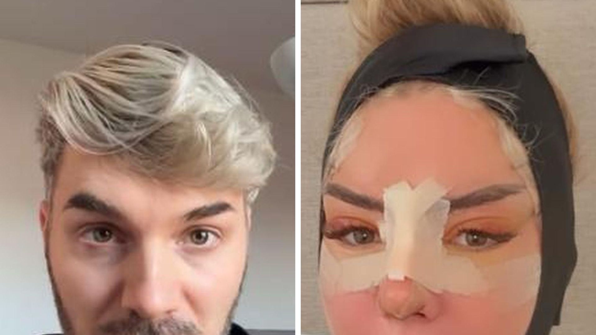 Sam Dylan warnt Fans vor Emma Fernlunds Beauty-Eingriffen