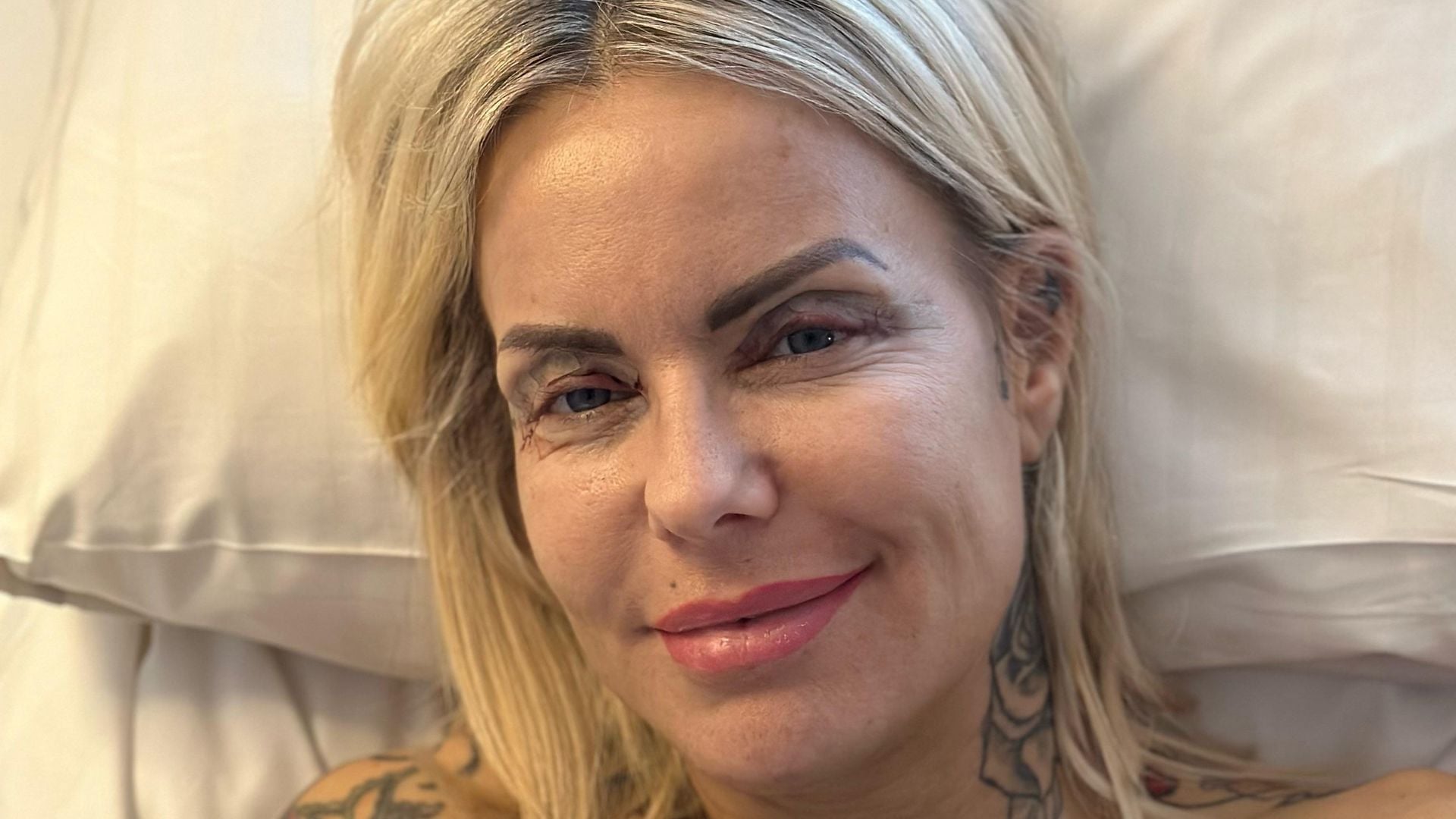 Vierstündiger Beauty-OP-Marathon: So geht es Desiree Hansen