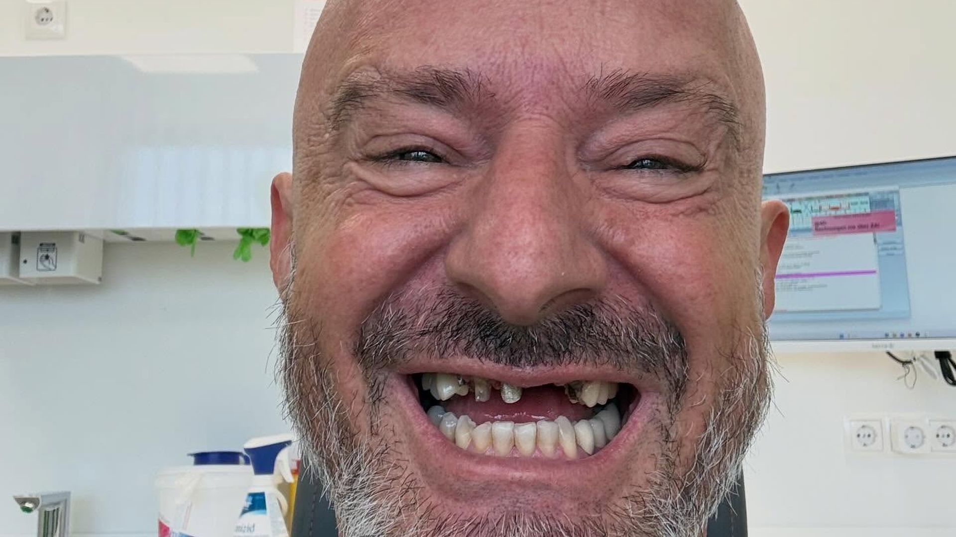 Detlef Steves ohne Zähne: Der Spott im Netz enttäuscht ihn