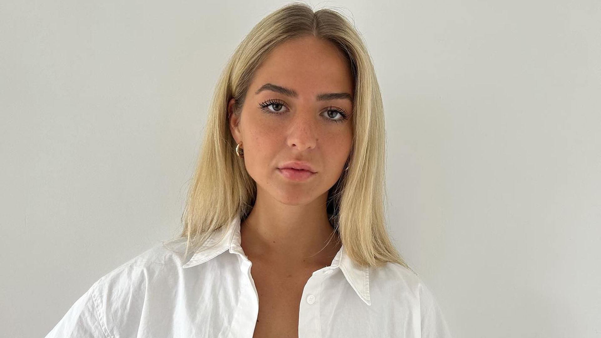 "Temptation Island V.I.P."-Emma hatte Beauty-Eingriffe!