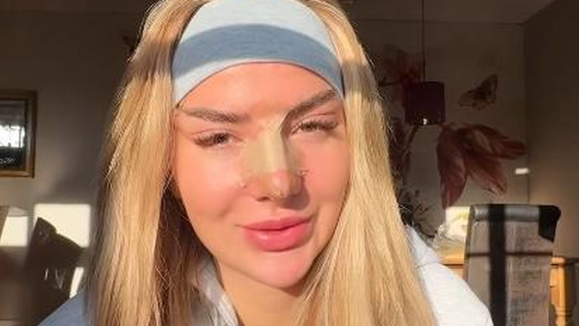 Emma Fernlund bewirbt Beauty-OP: Fans finden es "fahrlässig"