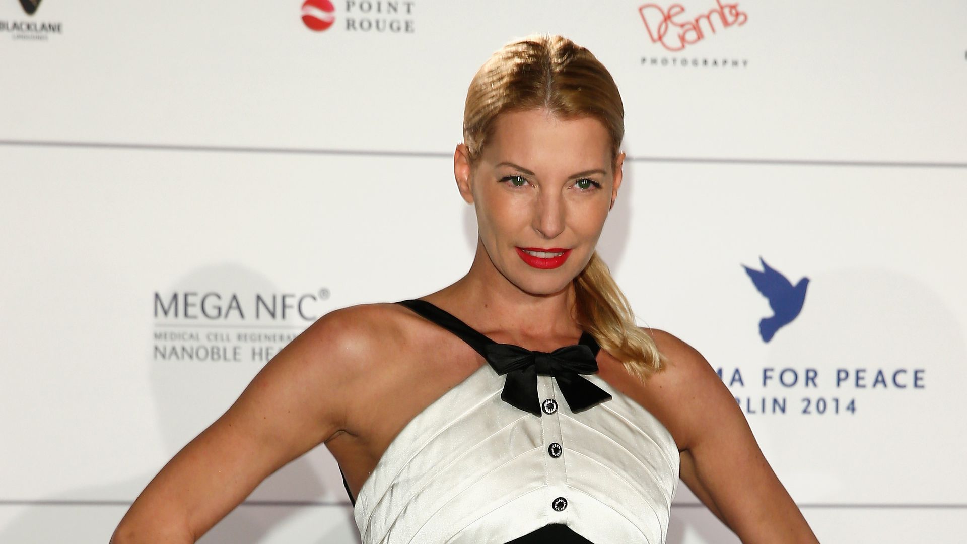 Beichte! Giulia Siegel leidet unter Hautkrankheit