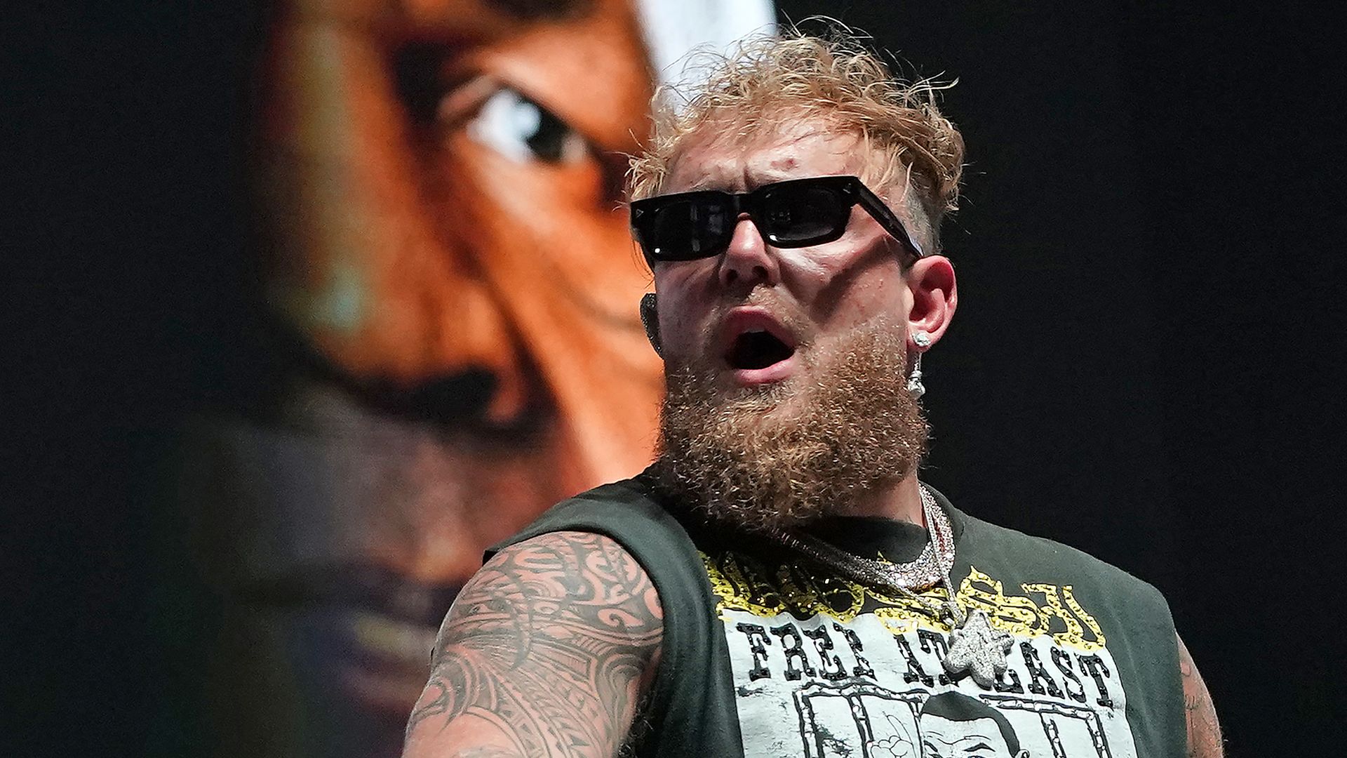 Jake Paul wird nach Box-Niederlage erneut am Kiefer operiert
