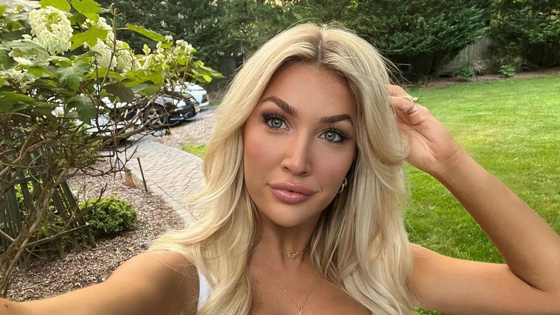 Influencerin Kate Cassidy enthüllt ihre Schönheitseingriffe