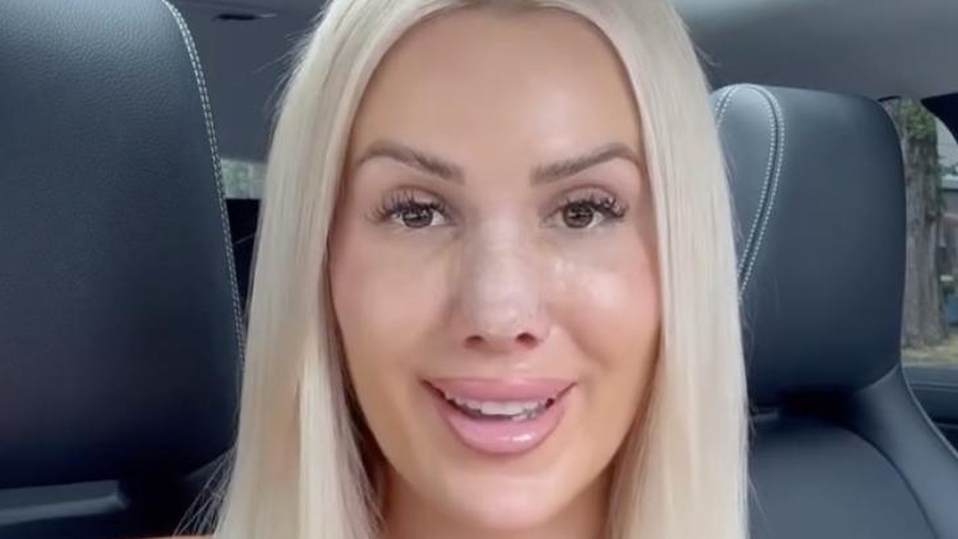 Laura Maria Lettgen hat sich die Nase operieren lassen