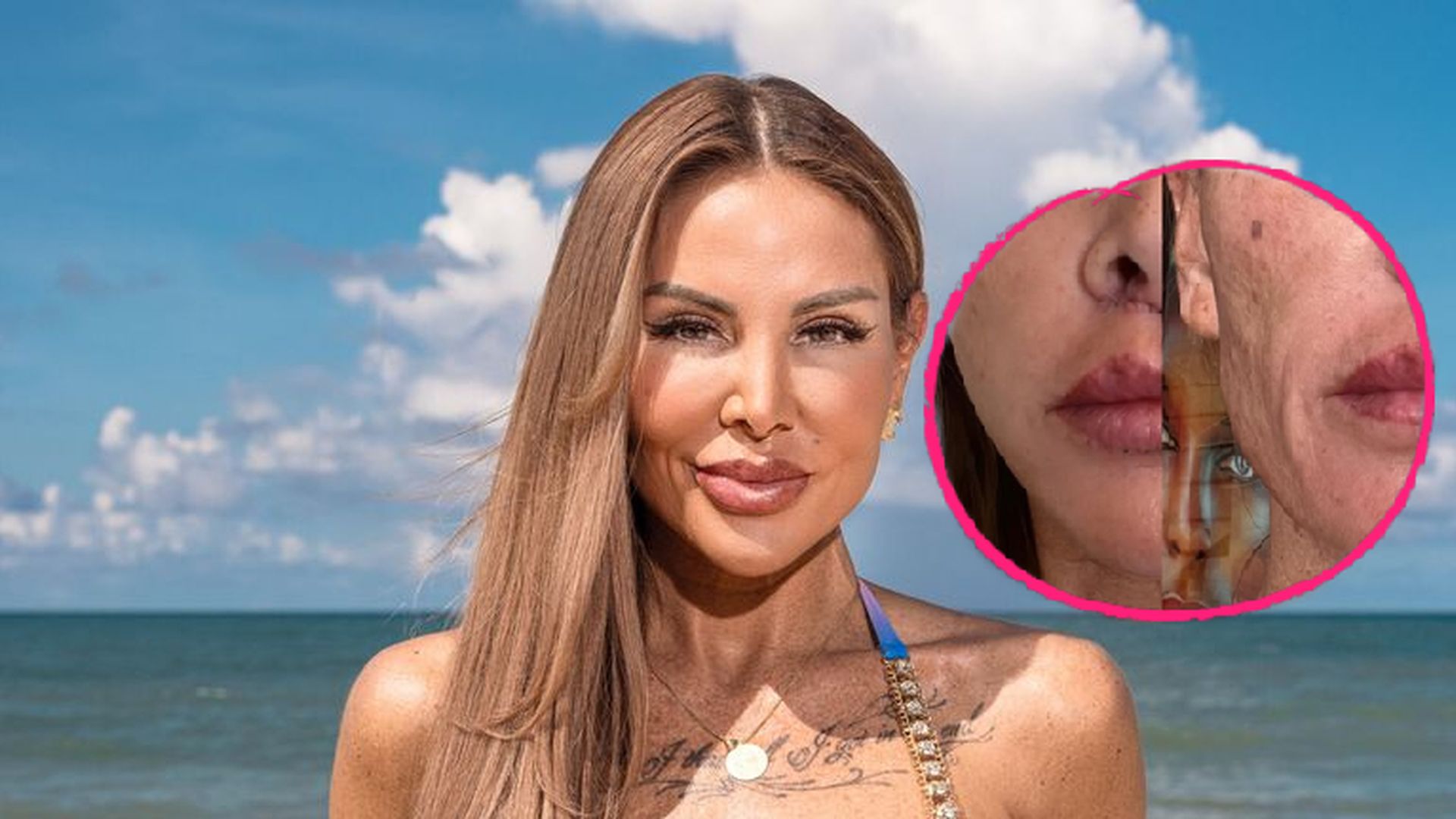 Nach Hylase: Lisha Savages Gesicht fiel "komplett zusammen"