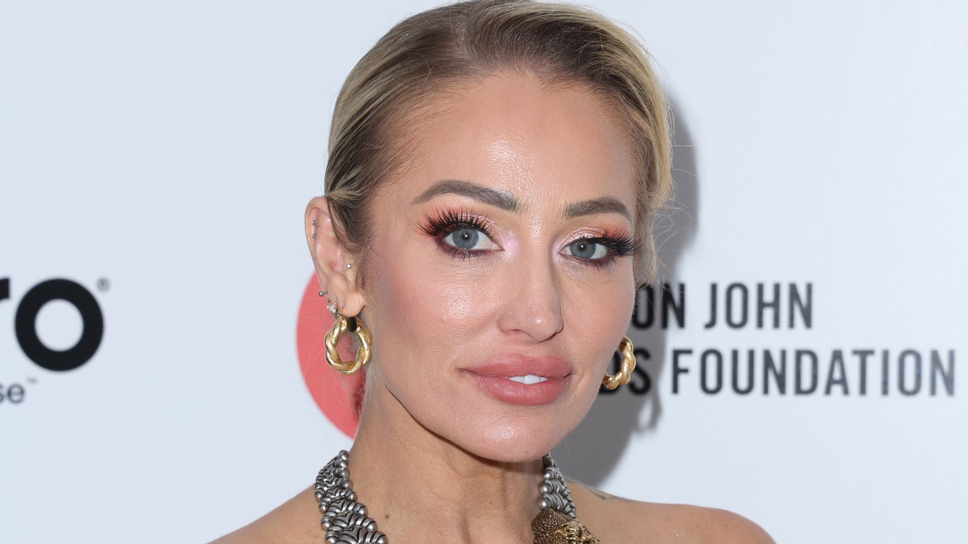 Nach Fehlgeburt: Mary Fitzgerald kämpft mit ihren Emotionen