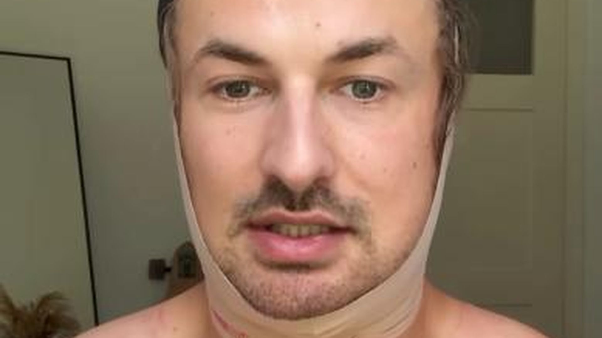 Nicolas Puschmann hatte vierte Brust-OP sowie Fettabsaugung