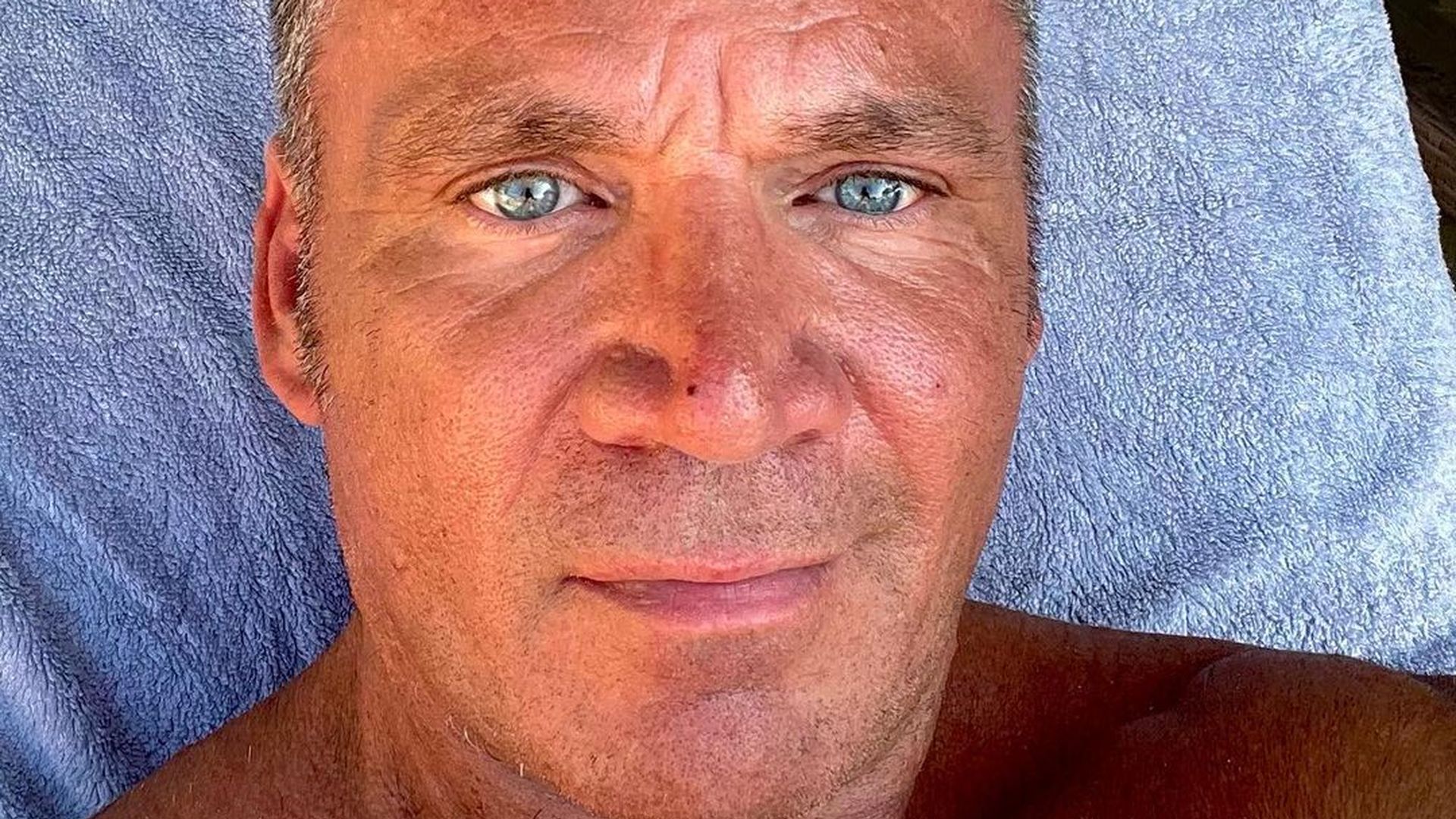 Unfall am Set: Peter Klein bei Dreharbeiten schwer verletzt