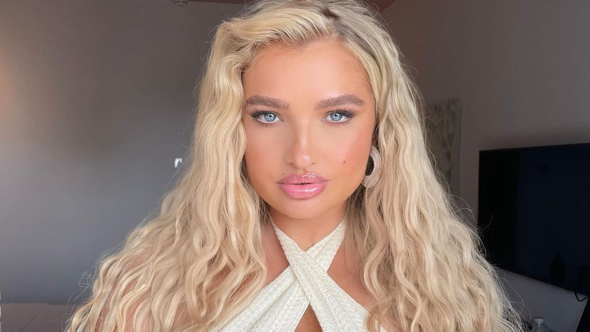 Tumor im Kopf: Model Sarina Nowak musste sich OP unterziehen