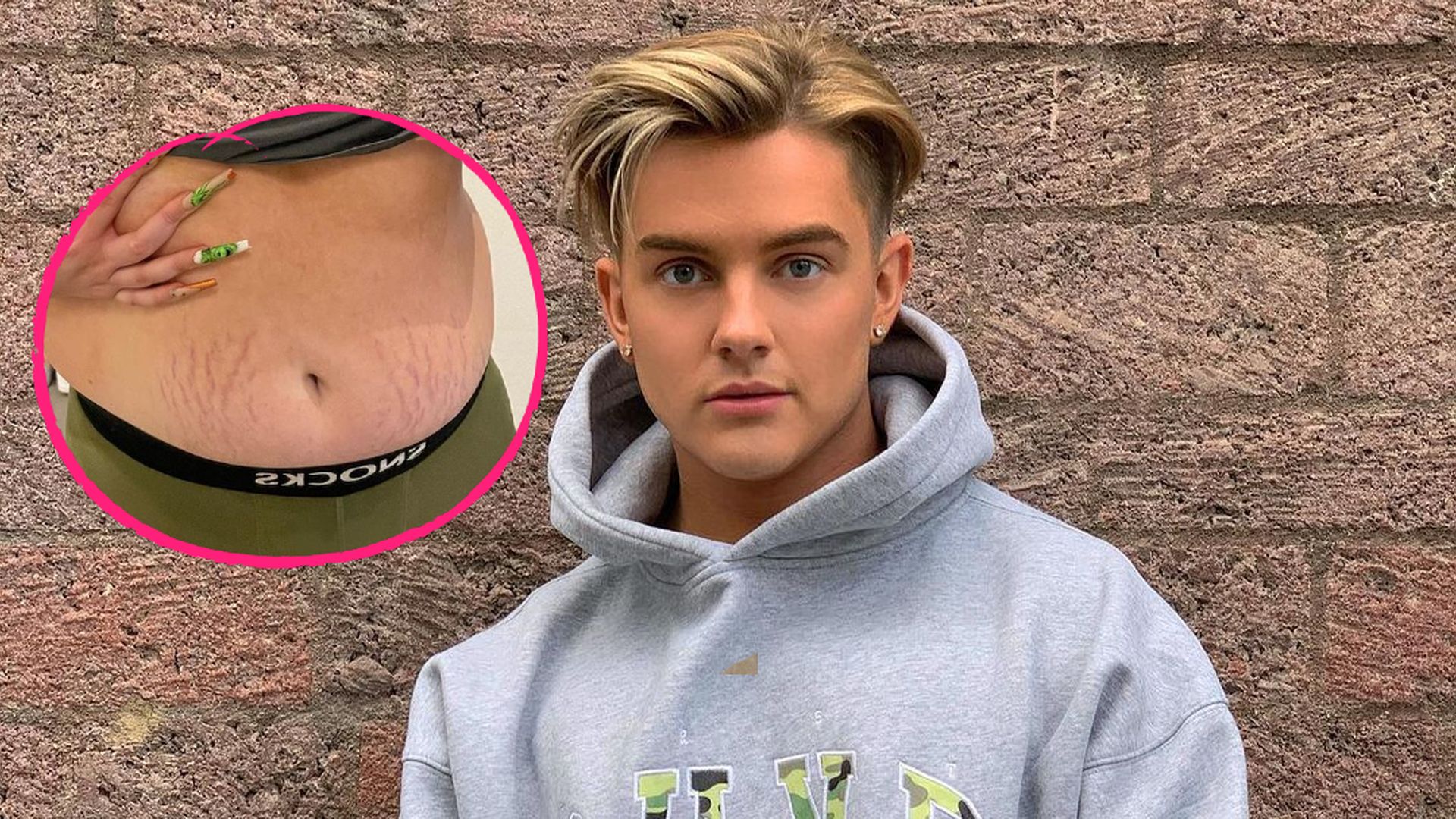 Mut zu "Makeln": Twenty4Tim zeigt seine Dehnungsstreifen