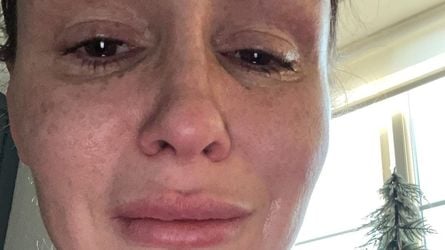 Chanelle Hayes präsentiert krassen Gewichtsverlust im Bikini