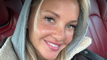 Krebsverdacht: Evelyn Burdecki wurde ein Leberfleck entfernt