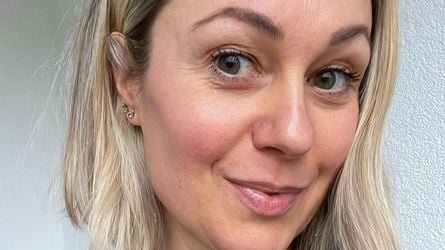 Missglückter Eingriff: Ruth Moschner verklagt Beauty-Klinik