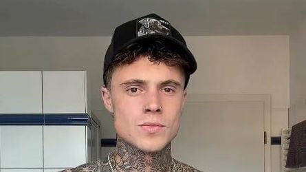 Update nach OP: Samuel Dohmen teilt Foto von XXL-Wunde