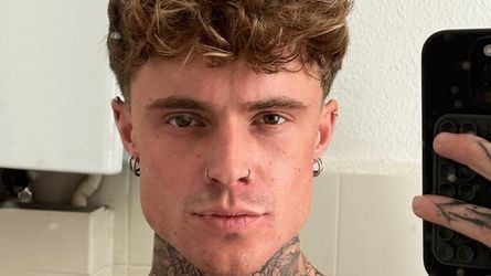 Update nach OP: Samuel Dohmen teilt Foto von XXL-Wunde