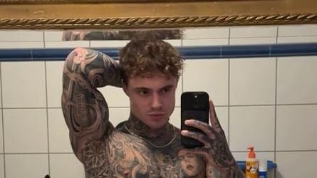 Update nach OP: Samuel Dohmen teilt Foto von XXL-Wunde